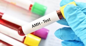 آزمایش AMH (آزمایش ذخیره تخمدان) | آزمایشگاه دکتر صالحی شیراز
